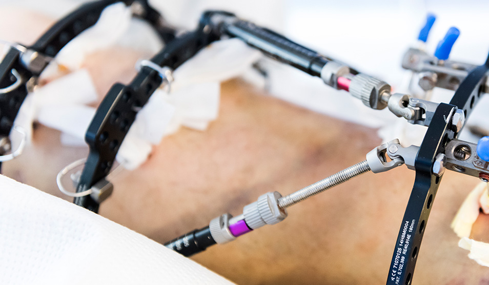 Trauma services | Imperial College Healthcare NHS Trust